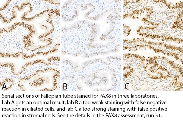NordiQC - Immunohistochemical Quality Control