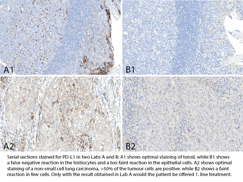 NordiQC - Immunohistochemical Quality Control