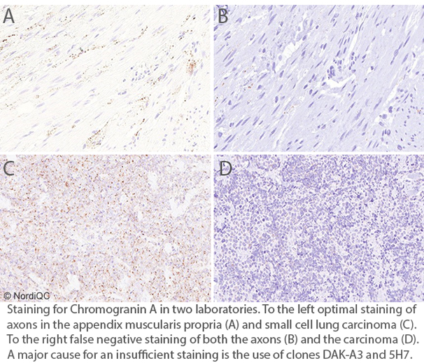 NordiQC - Immunohistochemical Quality Control
