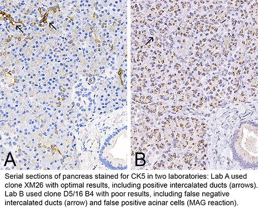 NordiQC - Immunohistochemical Quality Control