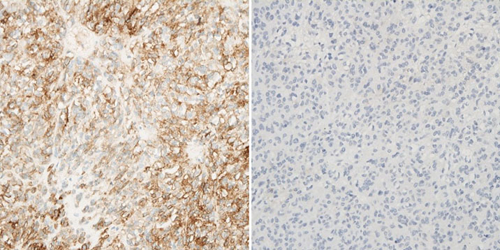 NordiQC - Immunohistochemical Quality Control