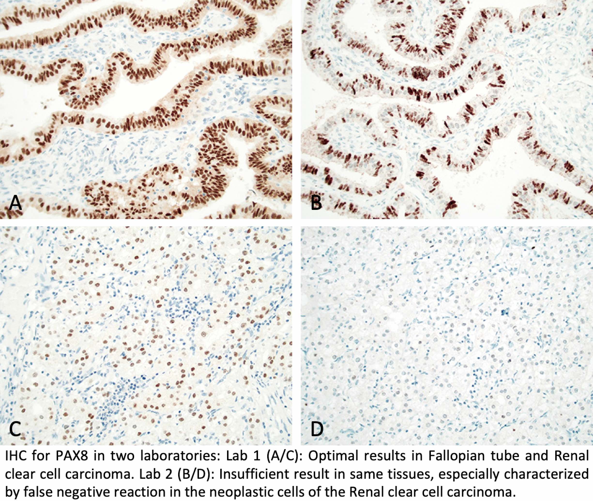 NordiQC - Immunohistochemical Quality Control