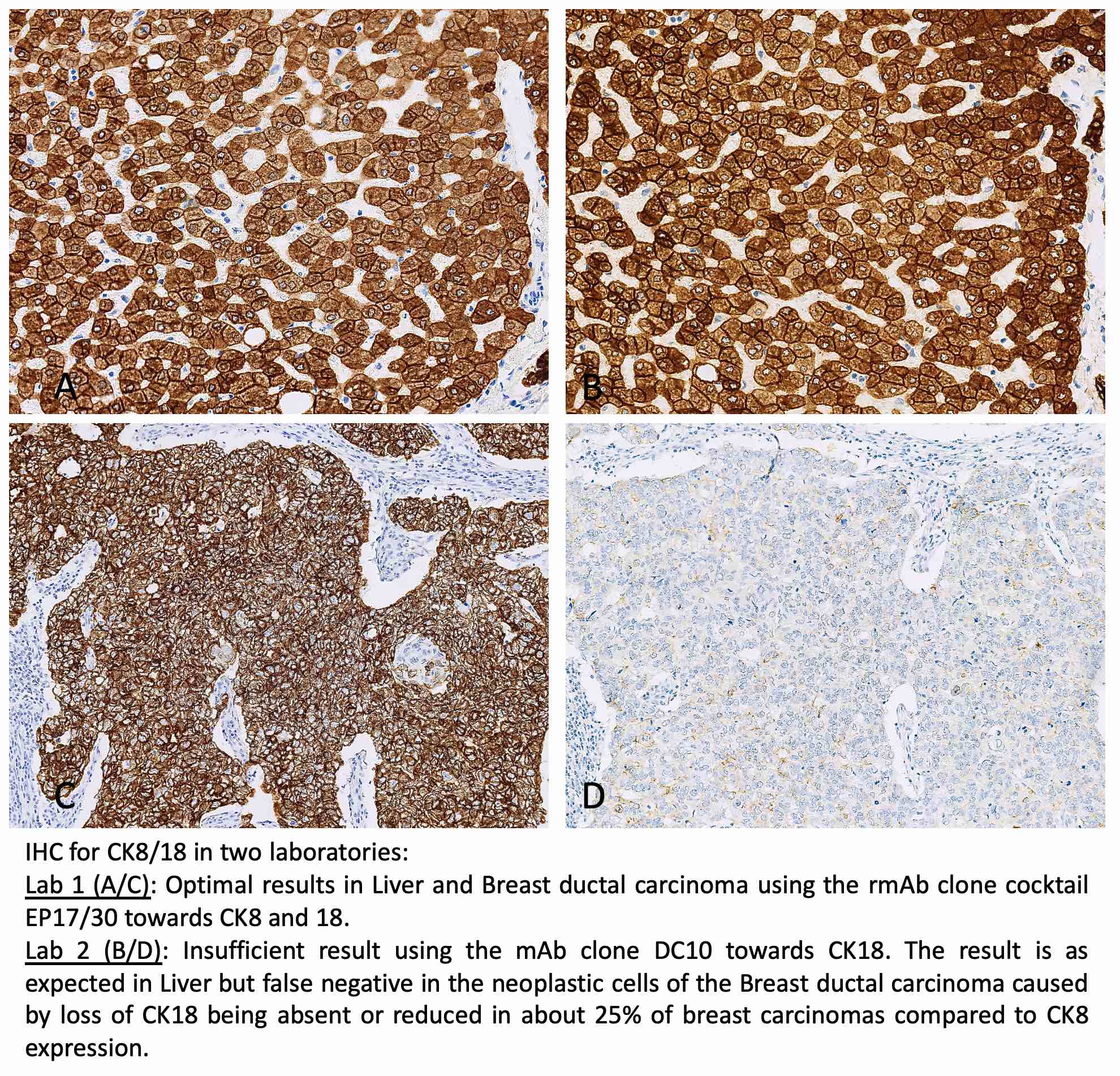 NordiQC - Immunohistochemical Quality Control