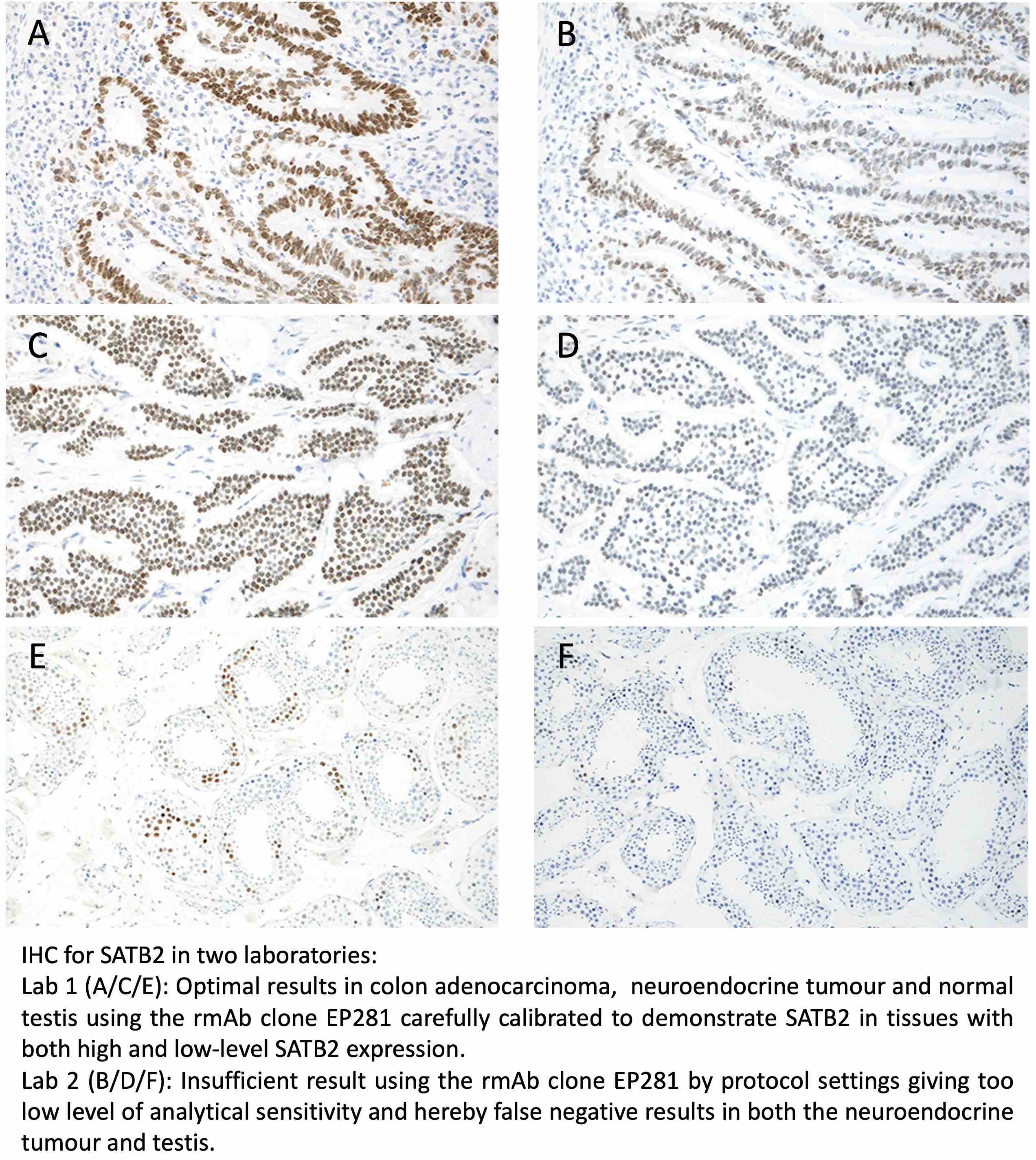 NordiQC - Immunohistochemical Quality Control