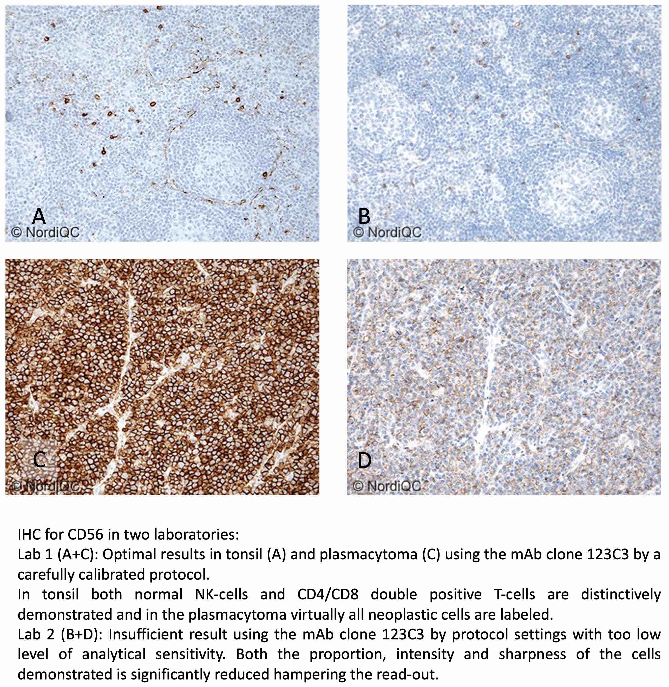 NordiQC - Immunohistochemical Quality Control