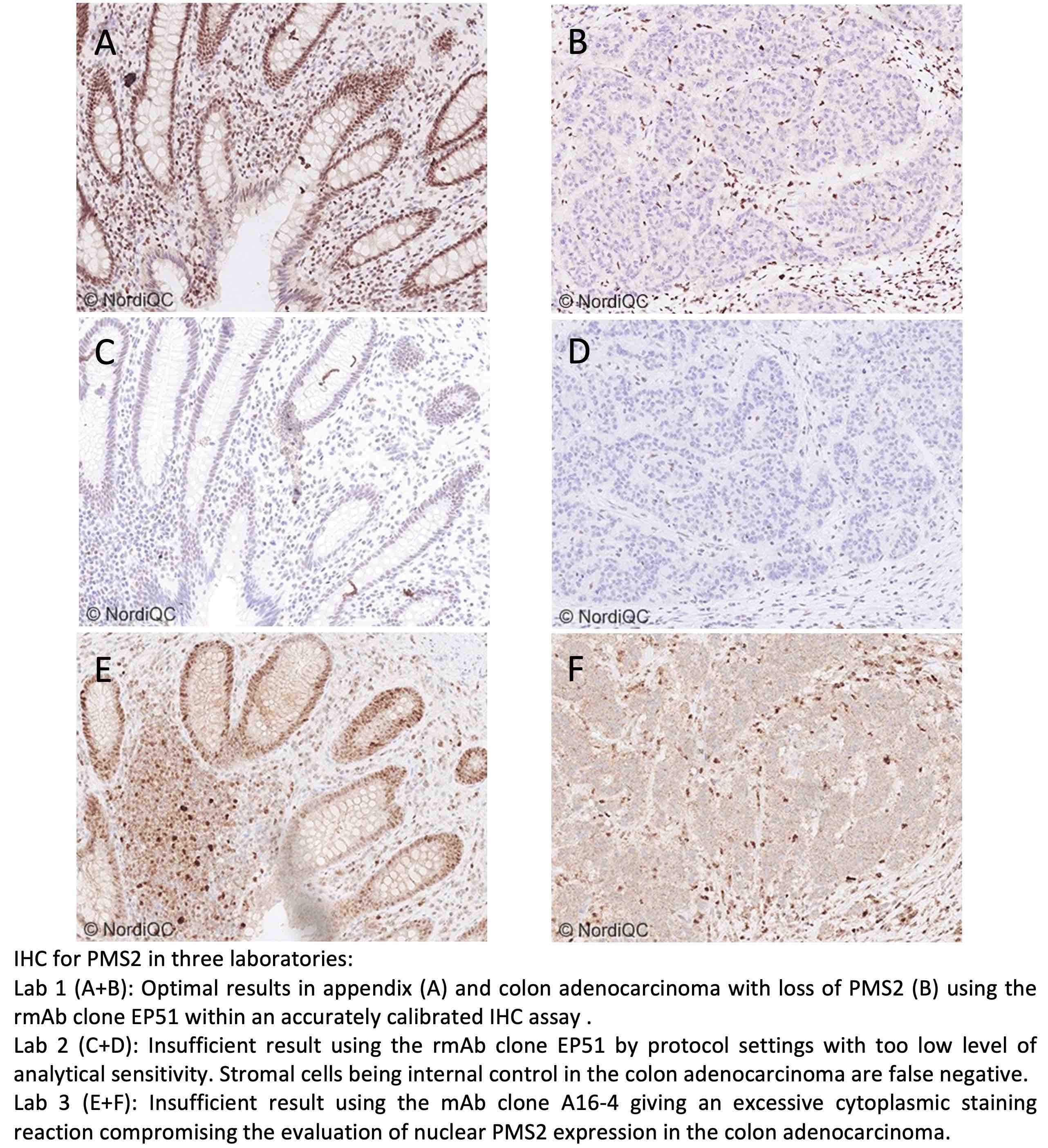 NordiQC - Immunohistochemical Quality Control