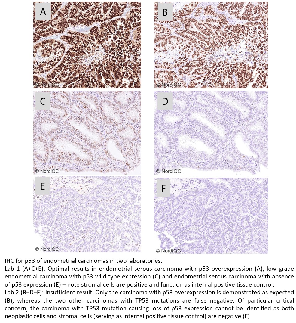 NordiQC - Immunohistochemical Quality Control