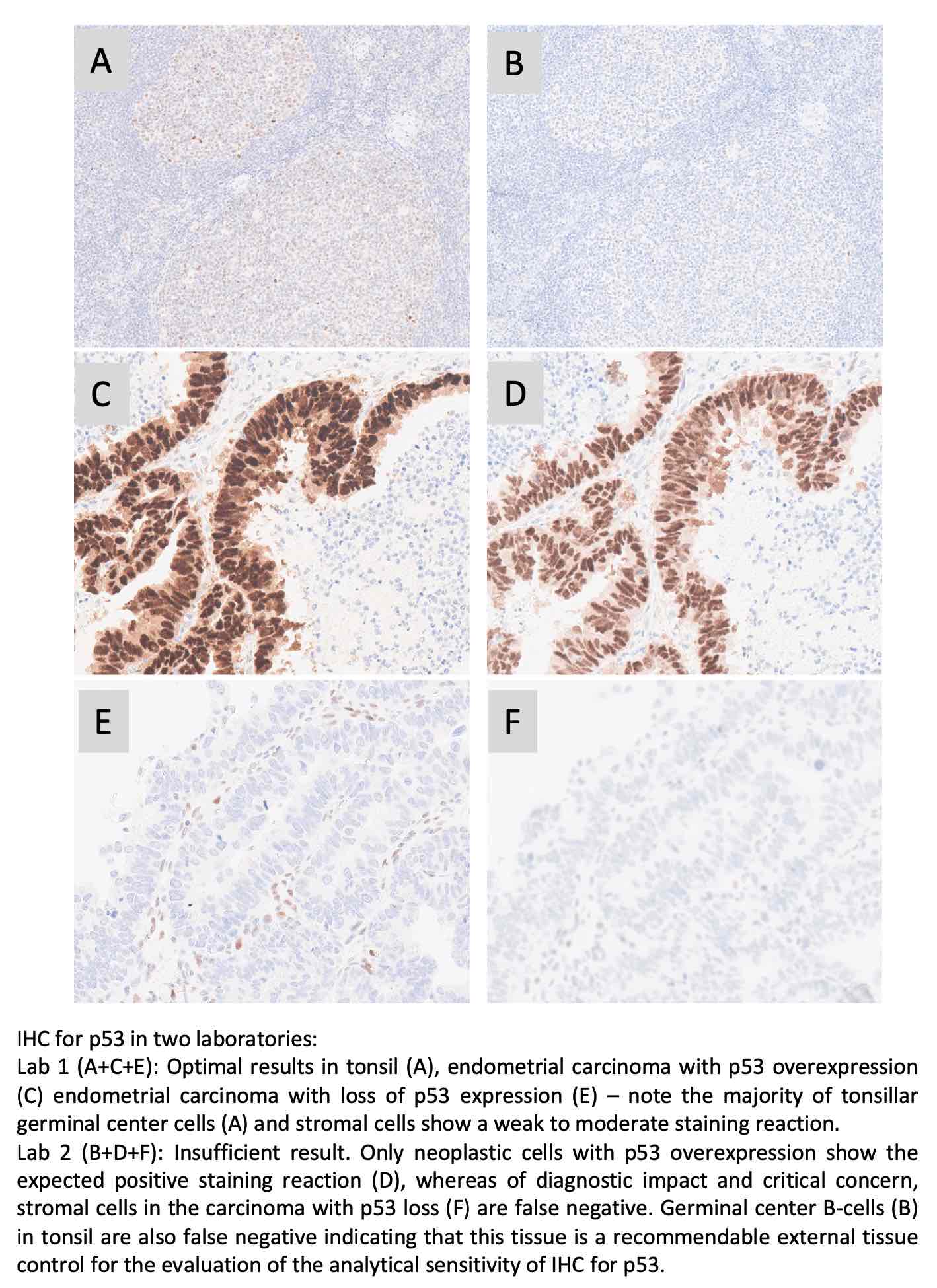 NordiQC - Immunohistochemical Quality Control