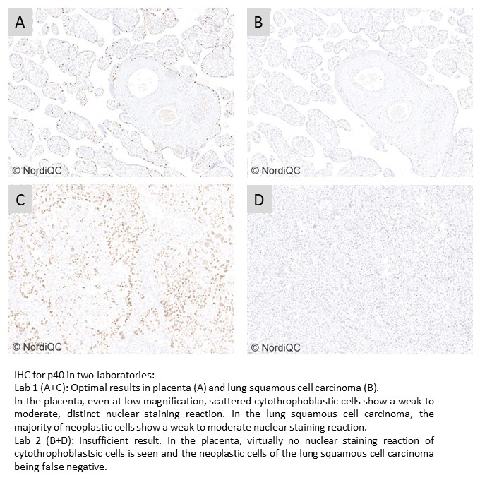 NordiQC - Immunohistochemical Quality Control