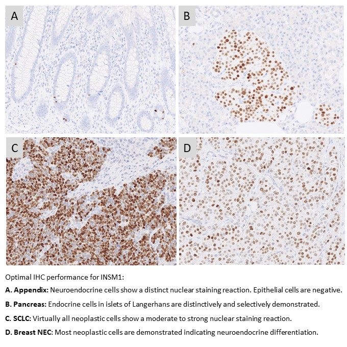 NordiQC - Immunohistochemical Quality Control