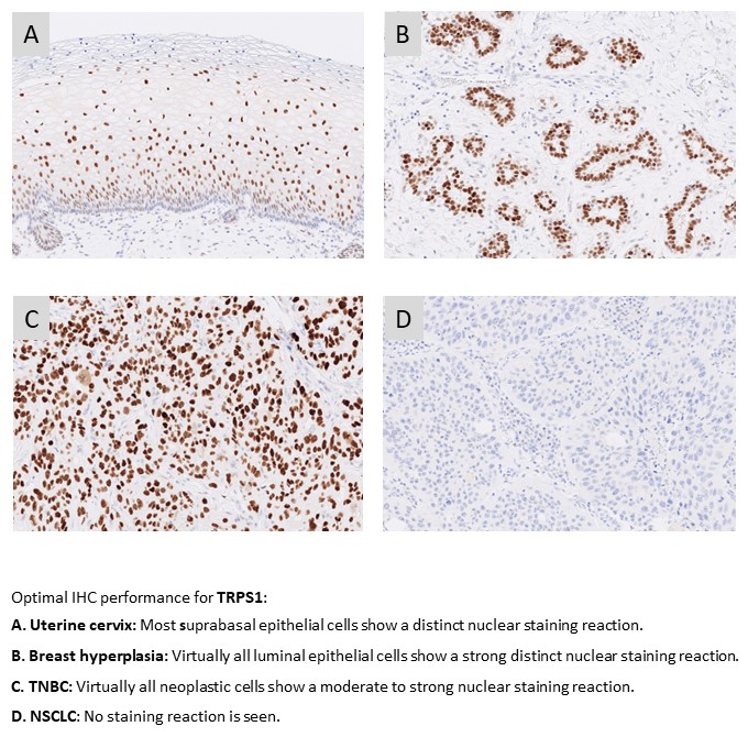 NordiQC - Immunohistochemical Quality Control