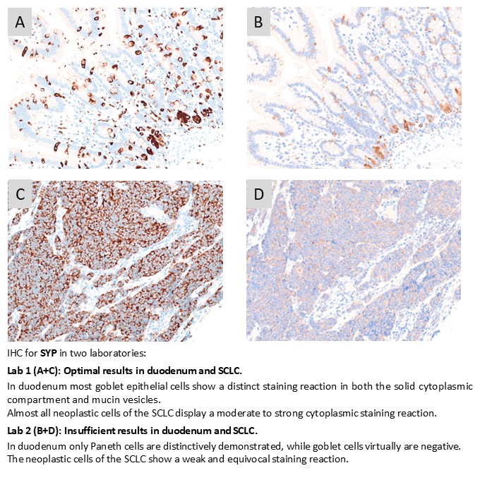NordiQC - Immunohistochemical Quality Control