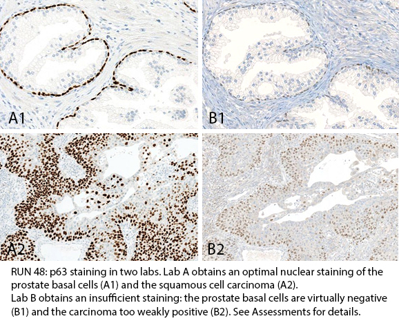 NordiQC - Immunohistochemical Quality Control